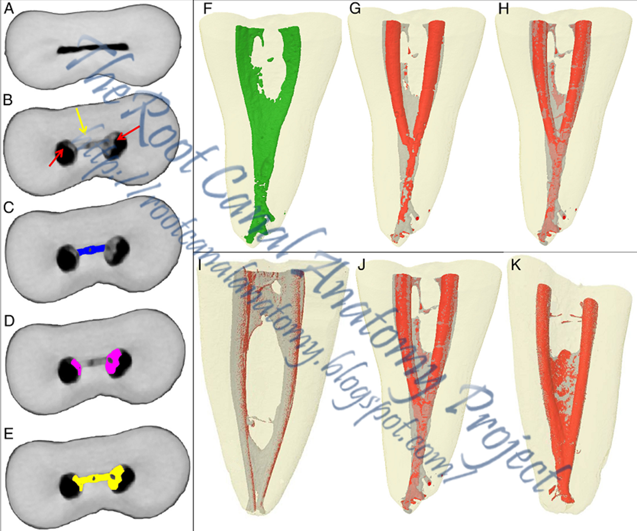 The Root Canal Anatomy Project: Publication JOE